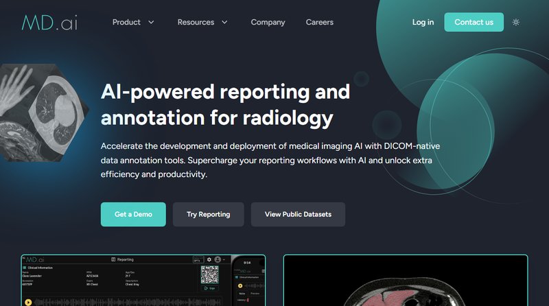 MD.ai 提供AI驱动的放射学报告和注释工具，加速医学影像AI的开发与部署。-SOAI.IM